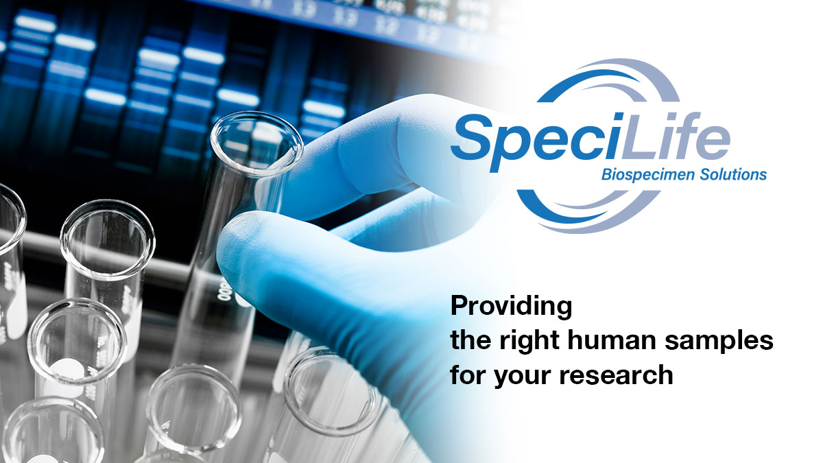 SpeciLife – Human Biospecimen Solutions – Providing the right human ...